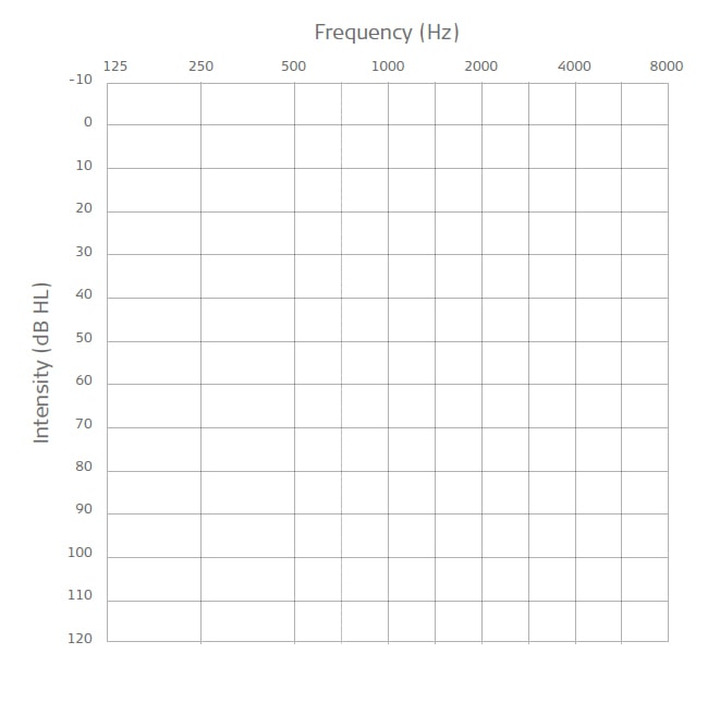 audiogram | Advanced Hearing WA